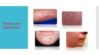 Skin rashes red flag symptoms | PPTX