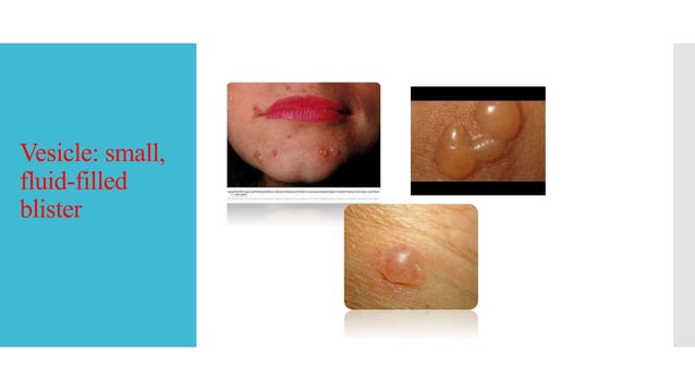 Skin rashes red flag symptoms | PPTX