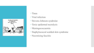 Skin rashes red flag symptoms | PPTX