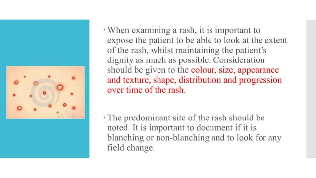 Skin rashes red flag symptoms | PPTX