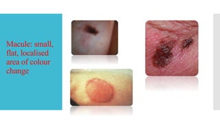 Skin rashes red flag symptoms | PPTX