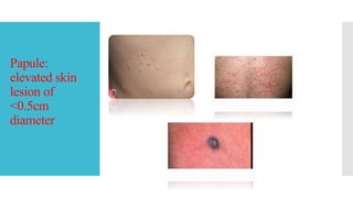 Skin rashes red flag symptoms | PPTX