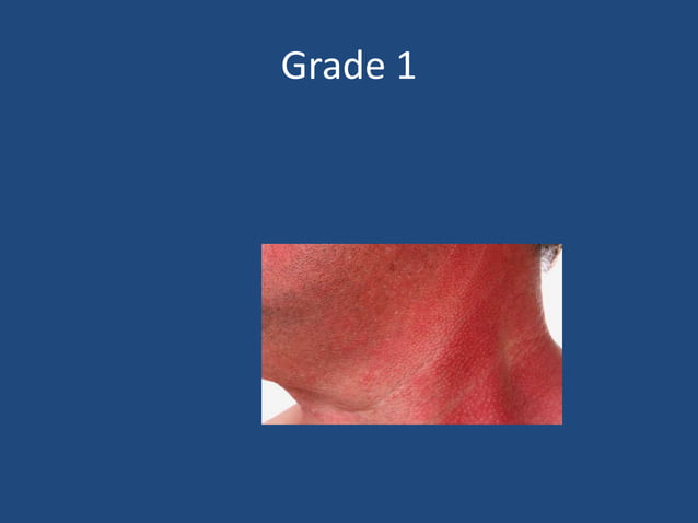 Radiotherapy and Skin reaction | PPTX