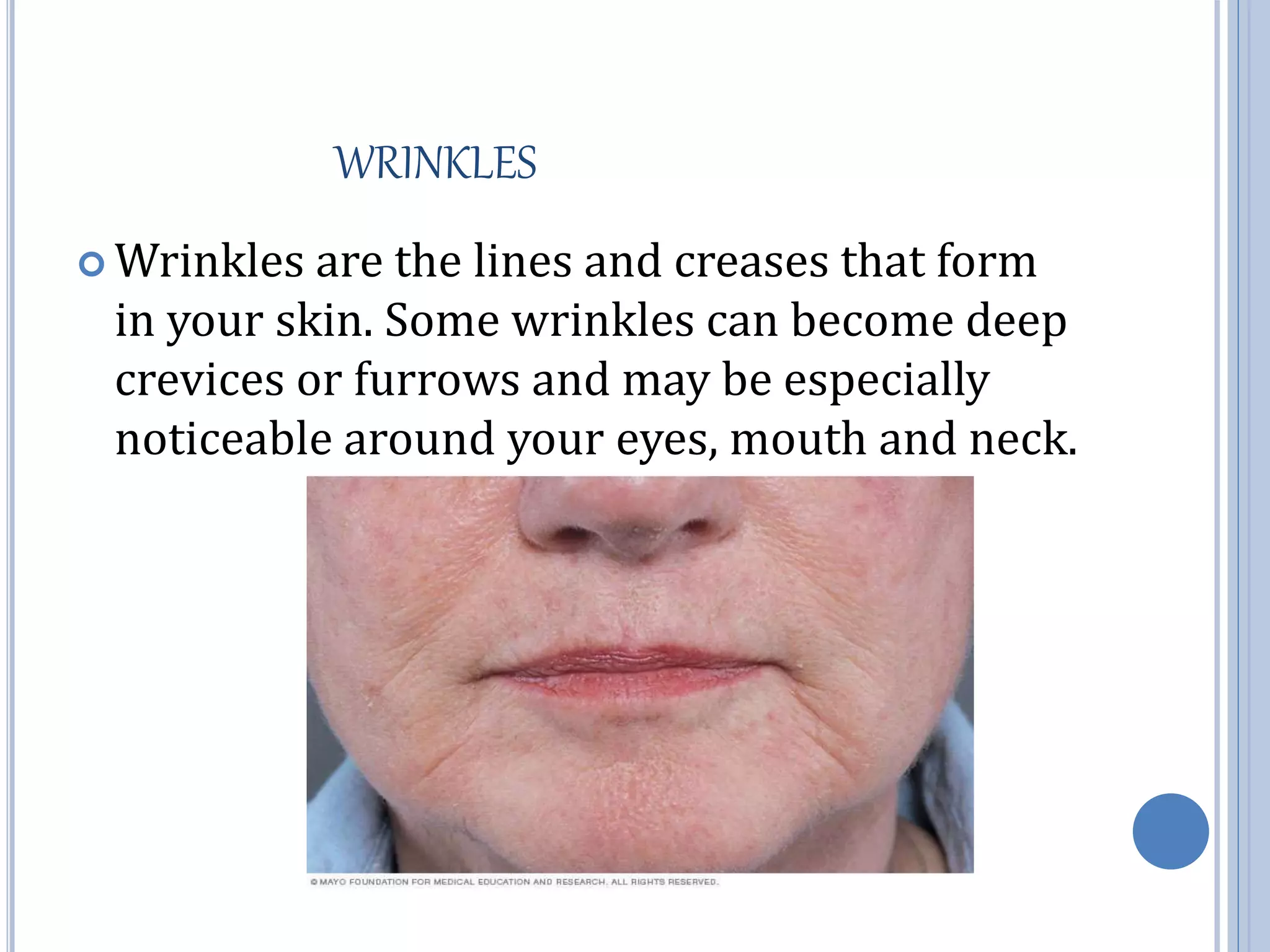 Skin relating problems in cosmetics | PPTX