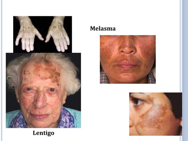 Skin relating problems in cosmetics | PPTX | Skin and Dermatology ...