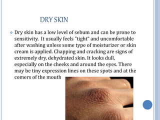 Skin relating problems in cosmetics | PPTX