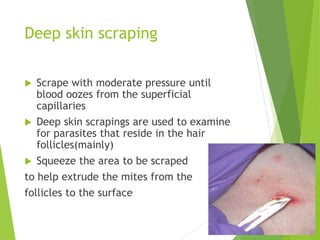 Skin scraping for diagnosis of parasitic diseases | PPTX