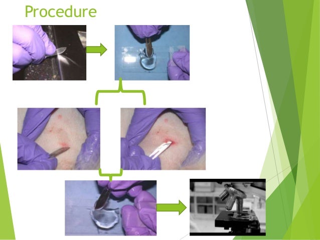 Skin scraping for diagnosis of parasitic diseases