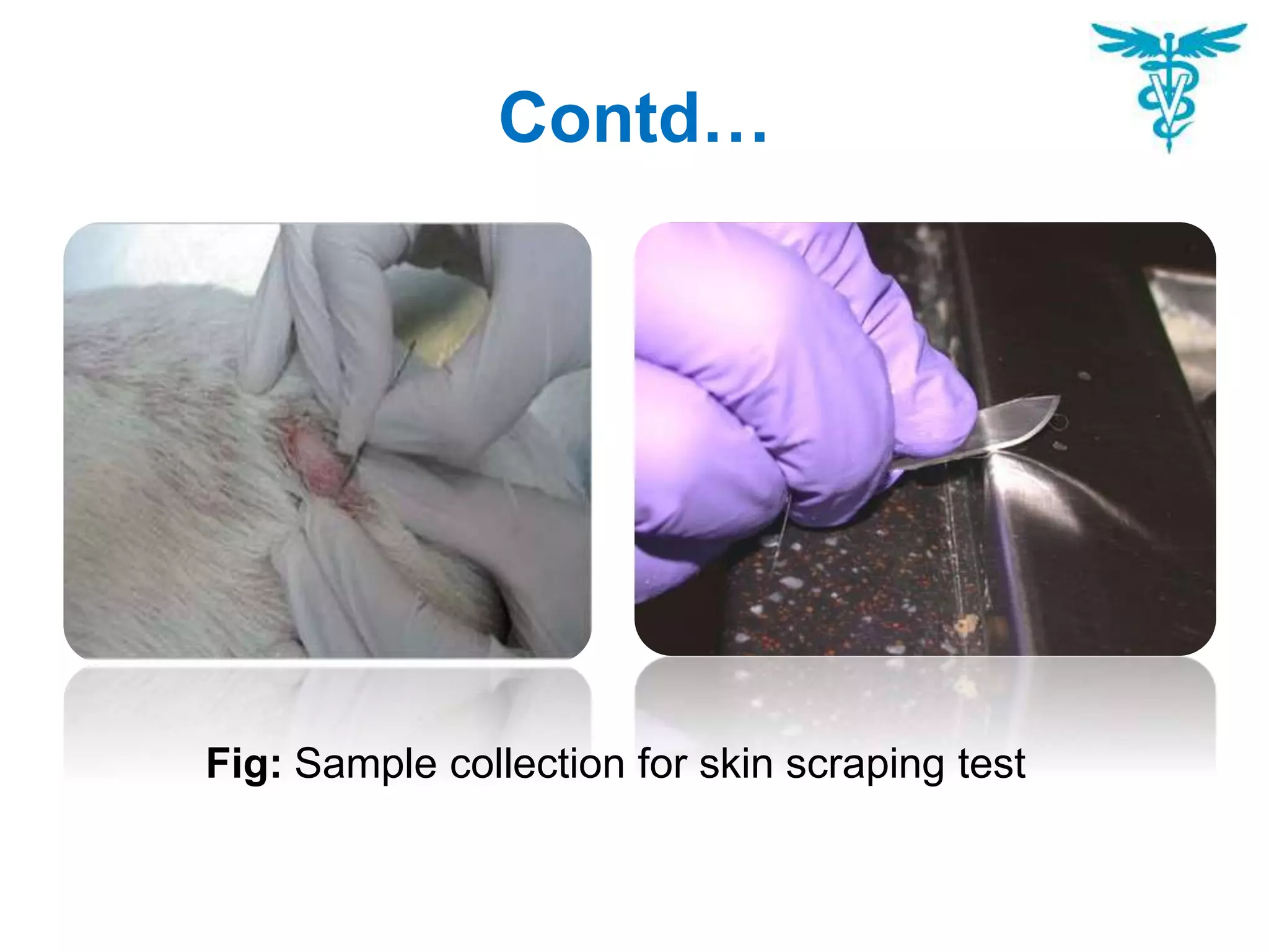 Skin scraping test | PPTX