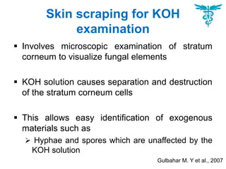 Skin scraping test | PPTX