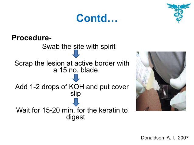 Skin scraping test | PPTX