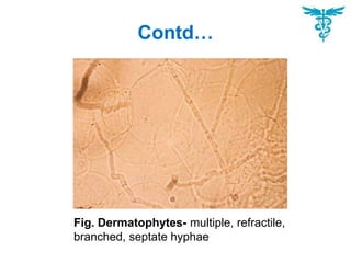 Skin scraping test | PPTX