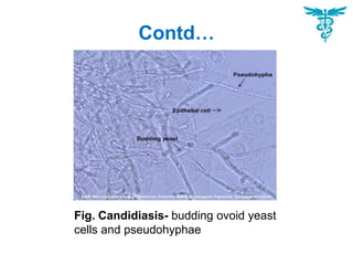 Skin scraping test | PPTX