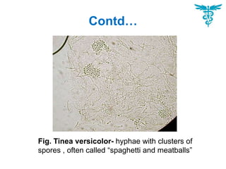 Skin scraping test | PPTX