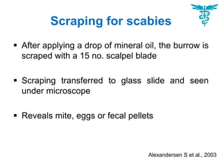 Skin scraping test | PPTX