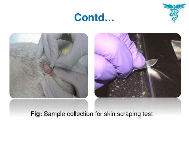 Skin scraping test