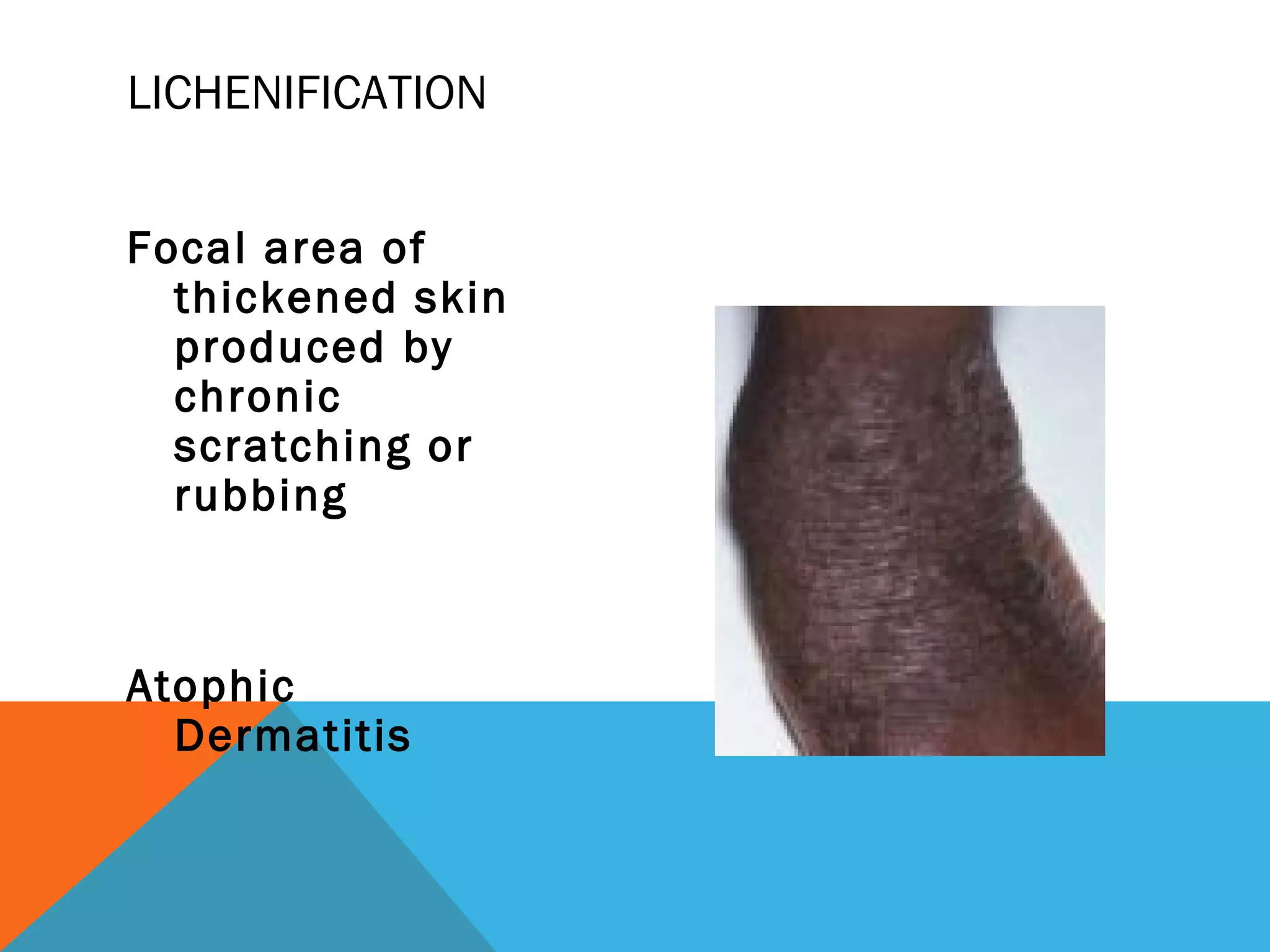 basics lesions of skin - Dr. Gurjot Marwah | PPT