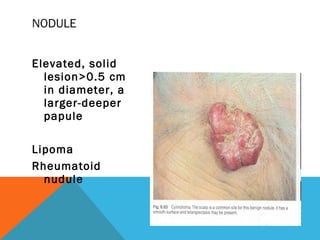 basics lesions of skin - Dr. Gurjot Marwah | PPT