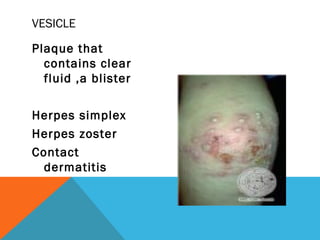 basics lesions of skin - Dr. Gurjot Marwah | PPT