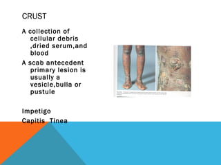 basics lesions of skin - Dr. Gurjot Marwah | PPT