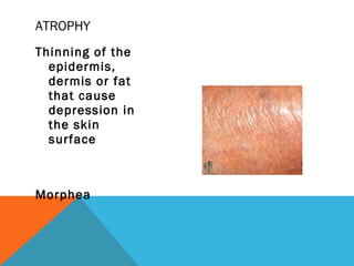 basics lesions of skin - Dr. Gurjot Marwah | PPT