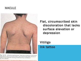 basics lesions of skin - Dr. Gurjot Marwah | PPT