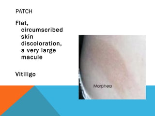 basics lesions of skin - Dr. Gurjot Marwah | PPT