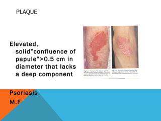 basics lesions of skin - Dr. Gurjot Marwah | PPT | Free Download