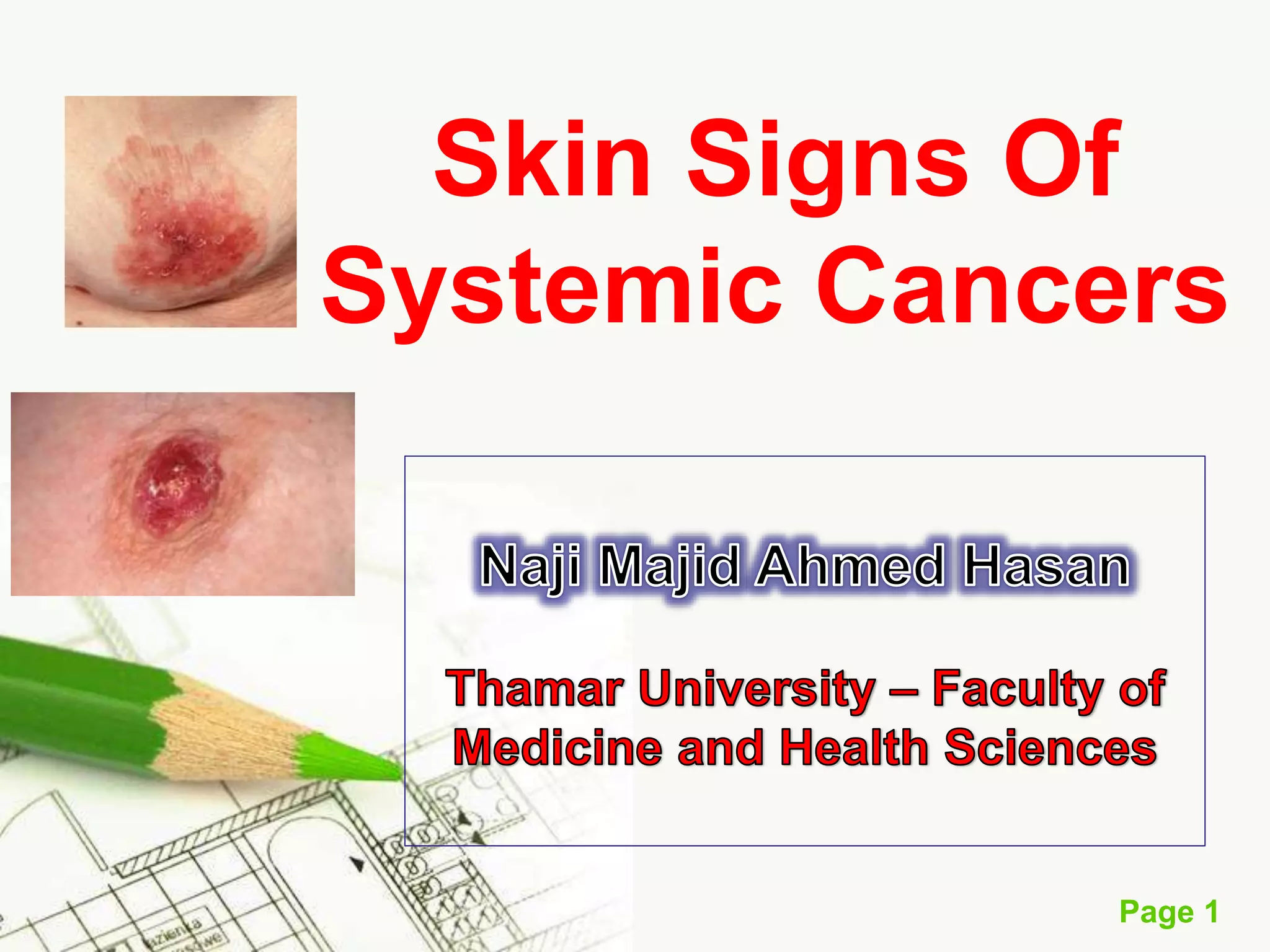 Skin Signs Of Systemic Cancers | PPT