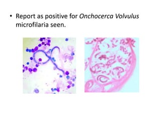 SKIN SNIP TECHNIQUE.pptx