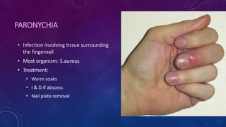 Skin, soft tissue, and hand infection | PPTX
