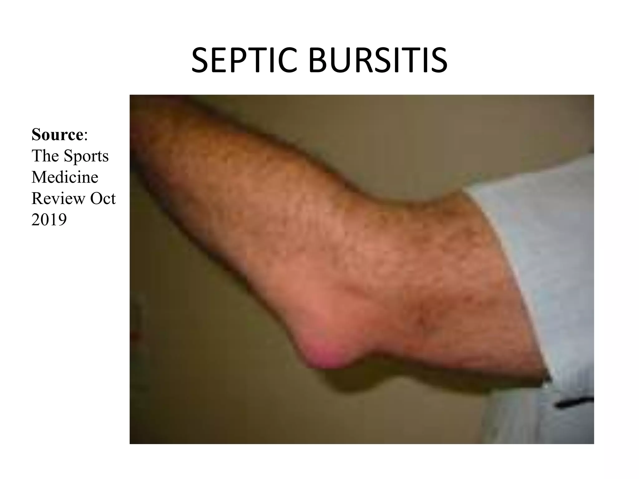 SKIN,SOFT TISSUE AND JOINTS INFECTIONS_07Dec2021.pptx | Skin and ...