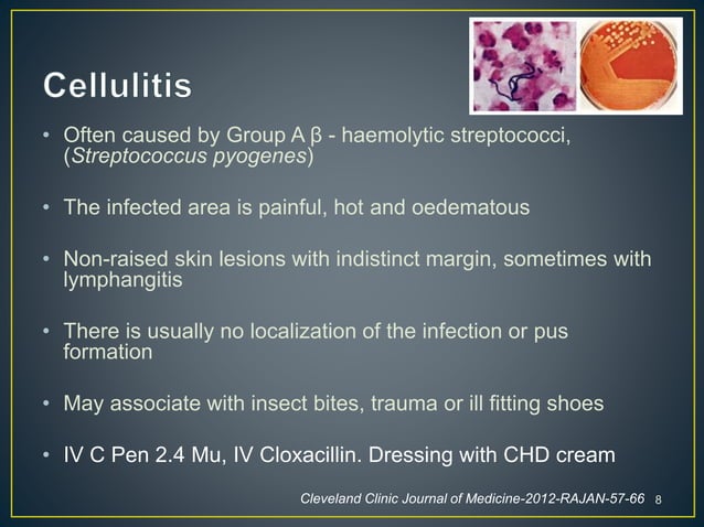 Skin &soft tissue infection | PPTX
