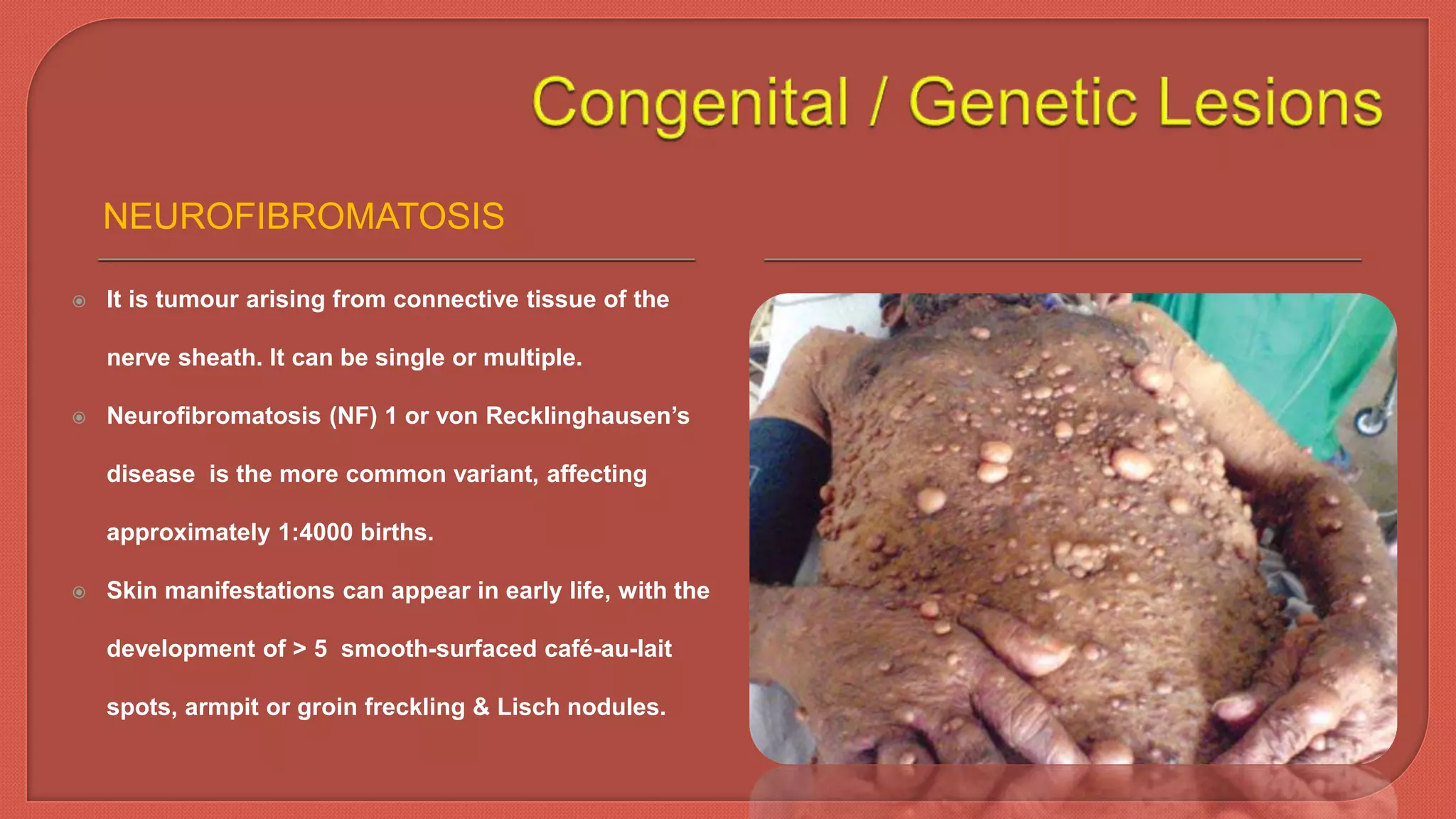 Skin & soft tissue lesions | PPTX