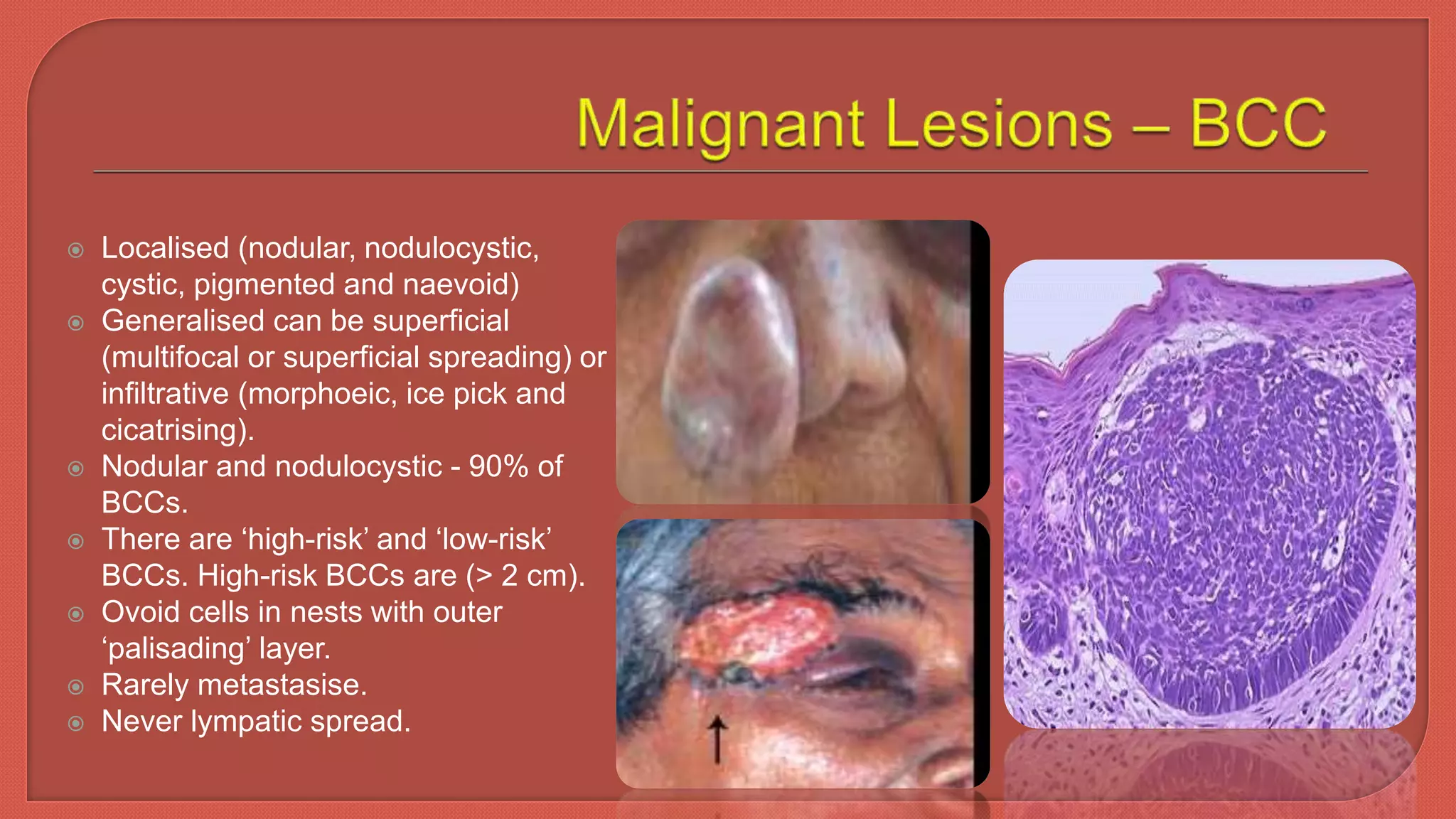 Skin & soft tissue lesions | PPTX