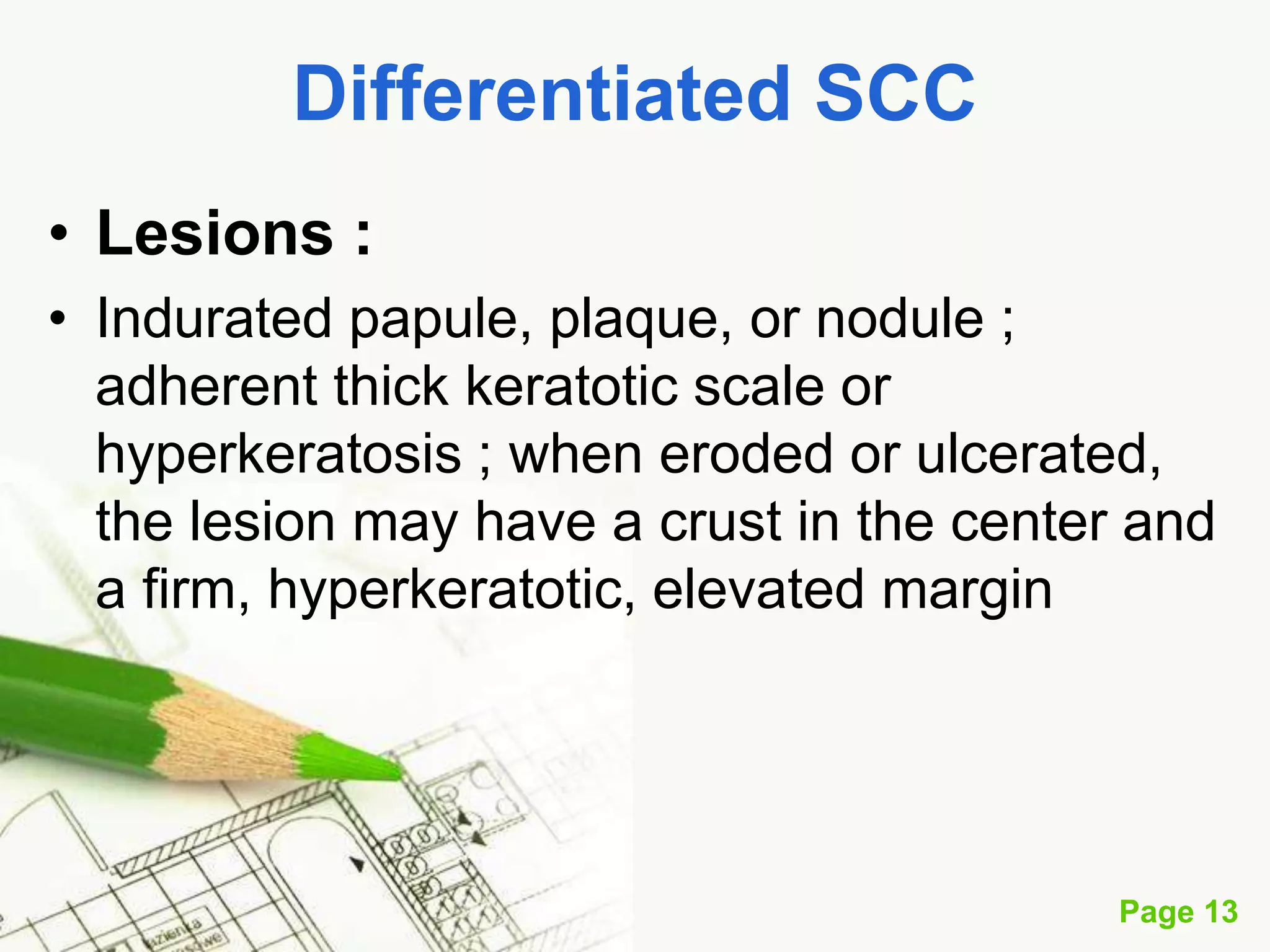 Squamous Cell Carcinoma (SCC) | PPT