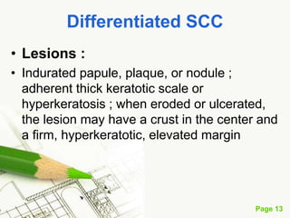 Squamous Cell Carcinoma (SCC) | PPT