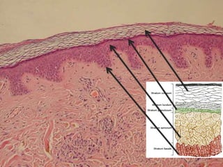Skin structure and development | PPTX | Skin and Dermatology | Diseases ...