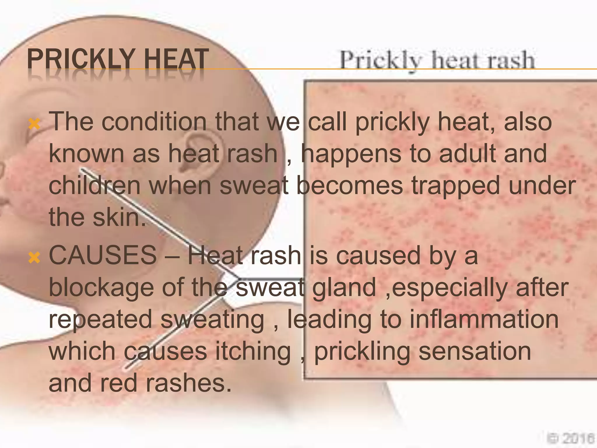 skin structure and skin related problem.pptx