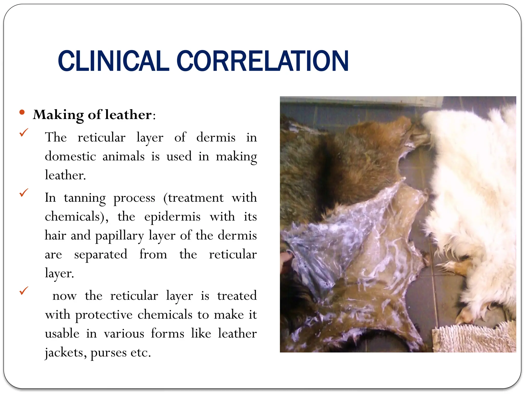 SKIN, SUPERFICIAL FASCIA AND DEEP FASCIA.pptx