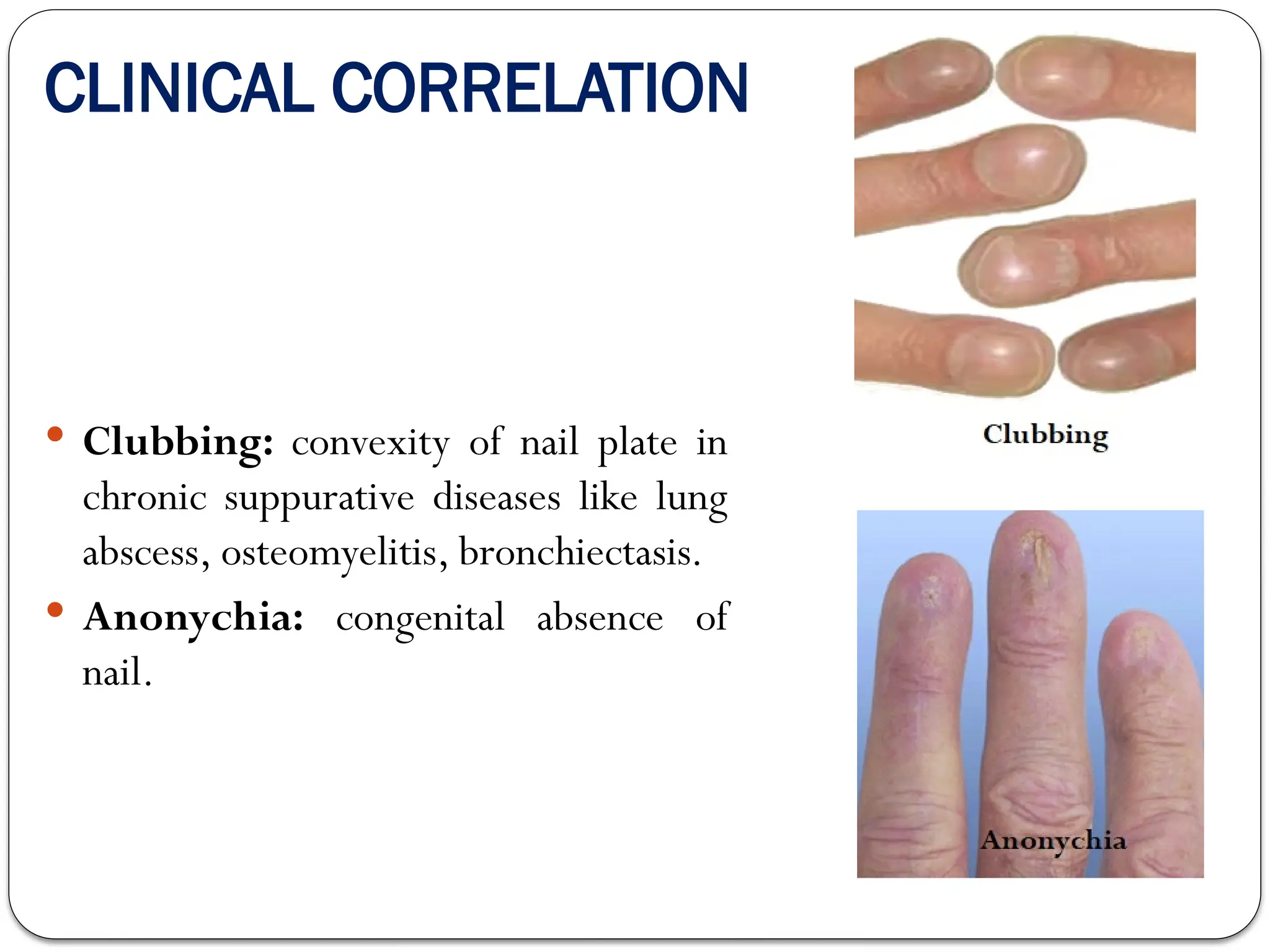 SKIN, SUPERFICIAL FASCIA AND DEEP FASCIA.pptx