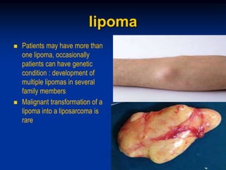 SKIN SWELINGS upload.pptx