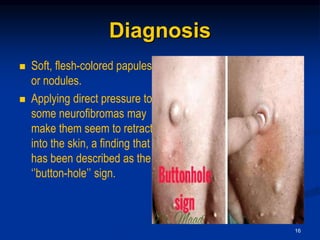 SKIN SWELINGS upload.pptx