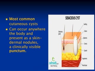 SKIN SWELINGS upload.pptx | Free Download