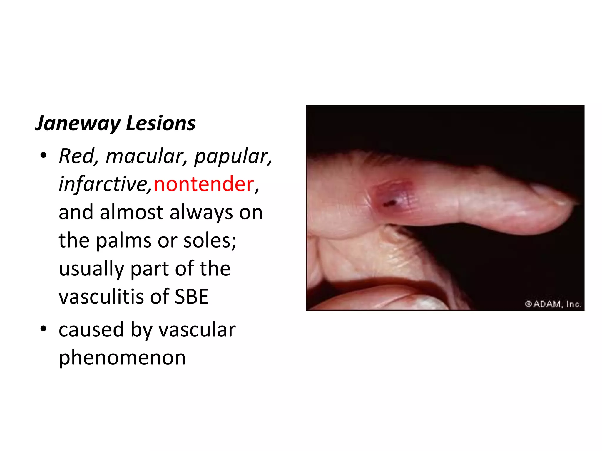 Skin systemic infections final | PDF