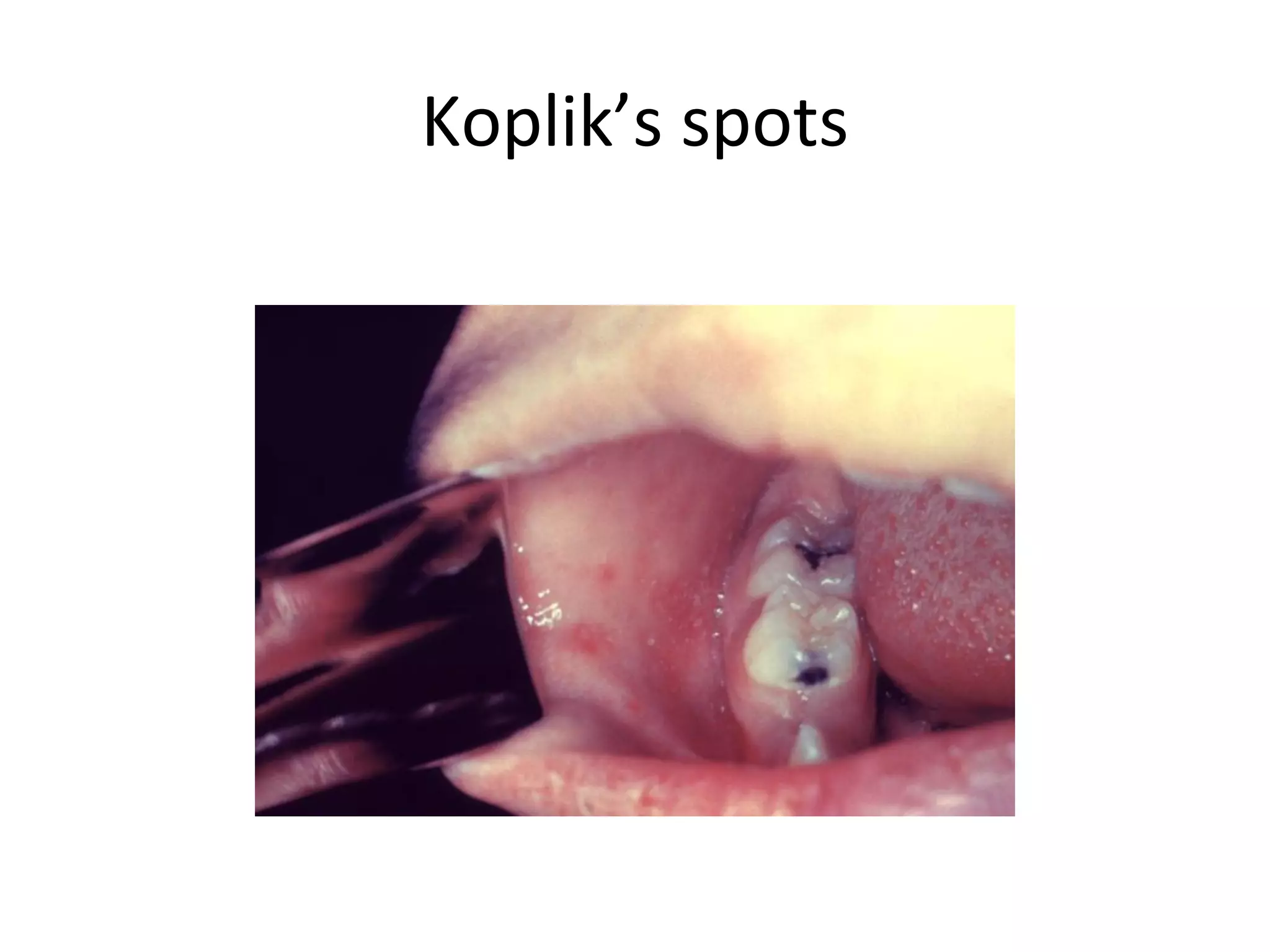 Skin systemic infections final | PDF