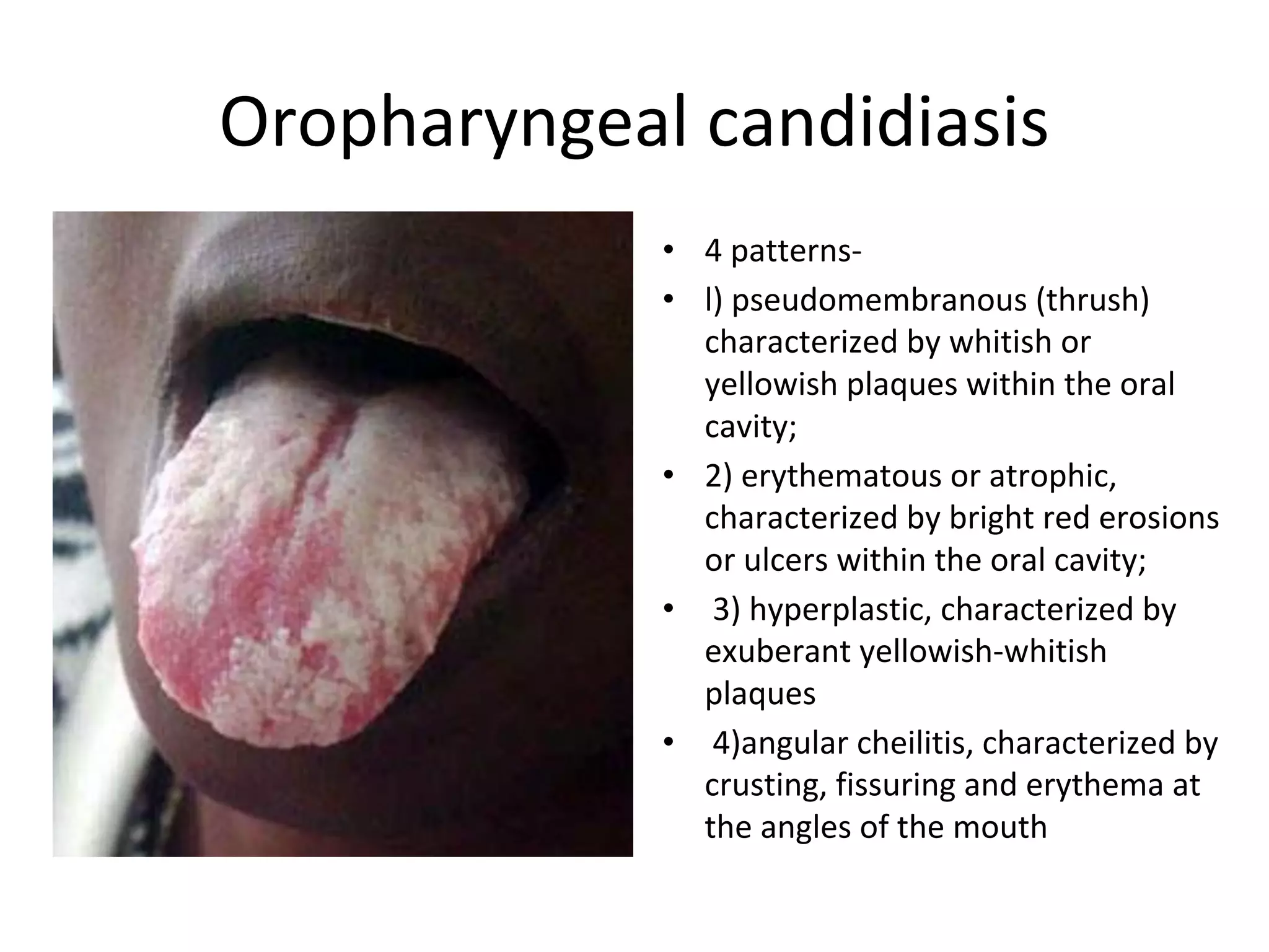 Skin systemic infections final | PDF