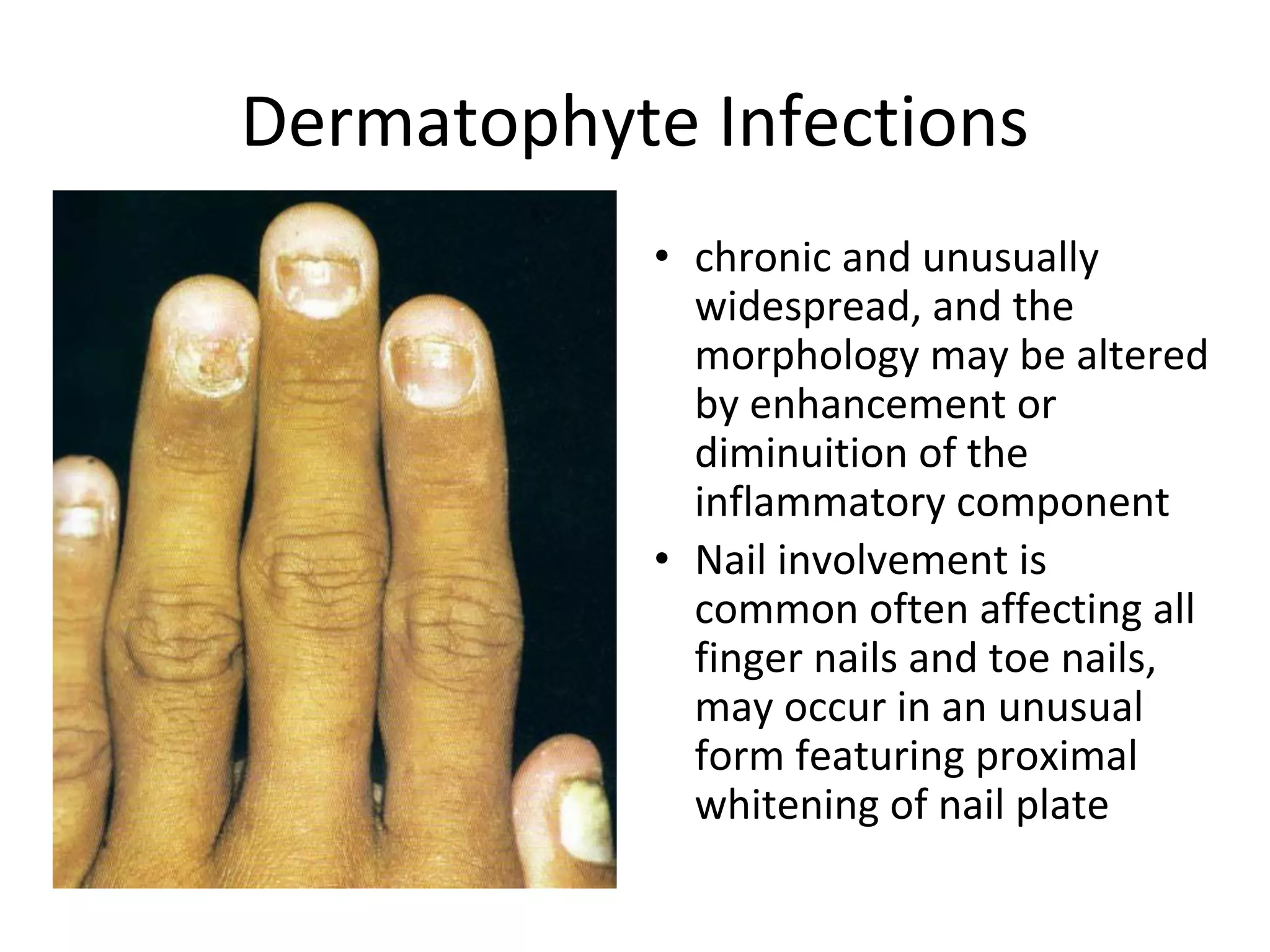Skin systemic infections final | PDF
