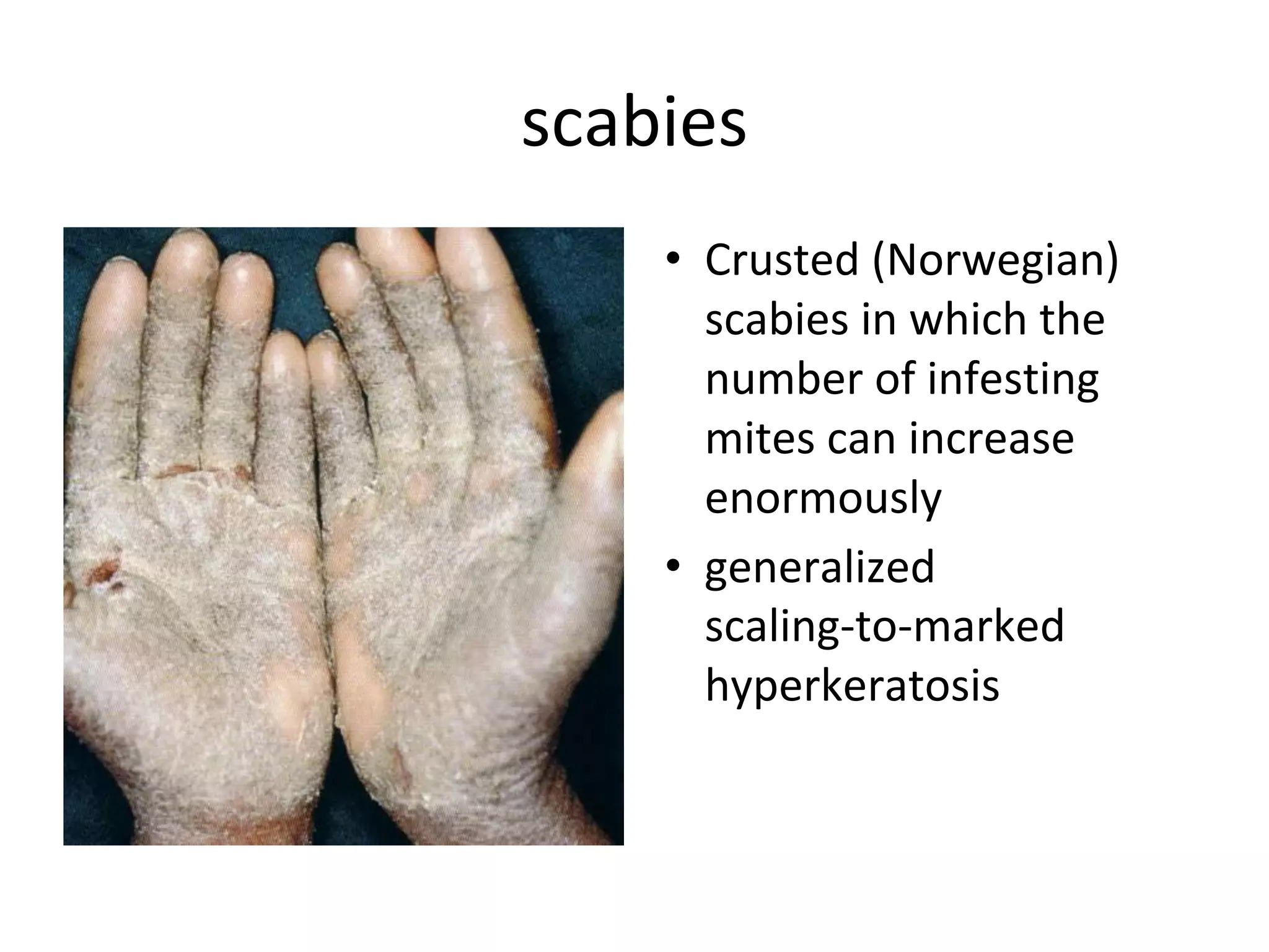 Skin systemic infections final | PDF