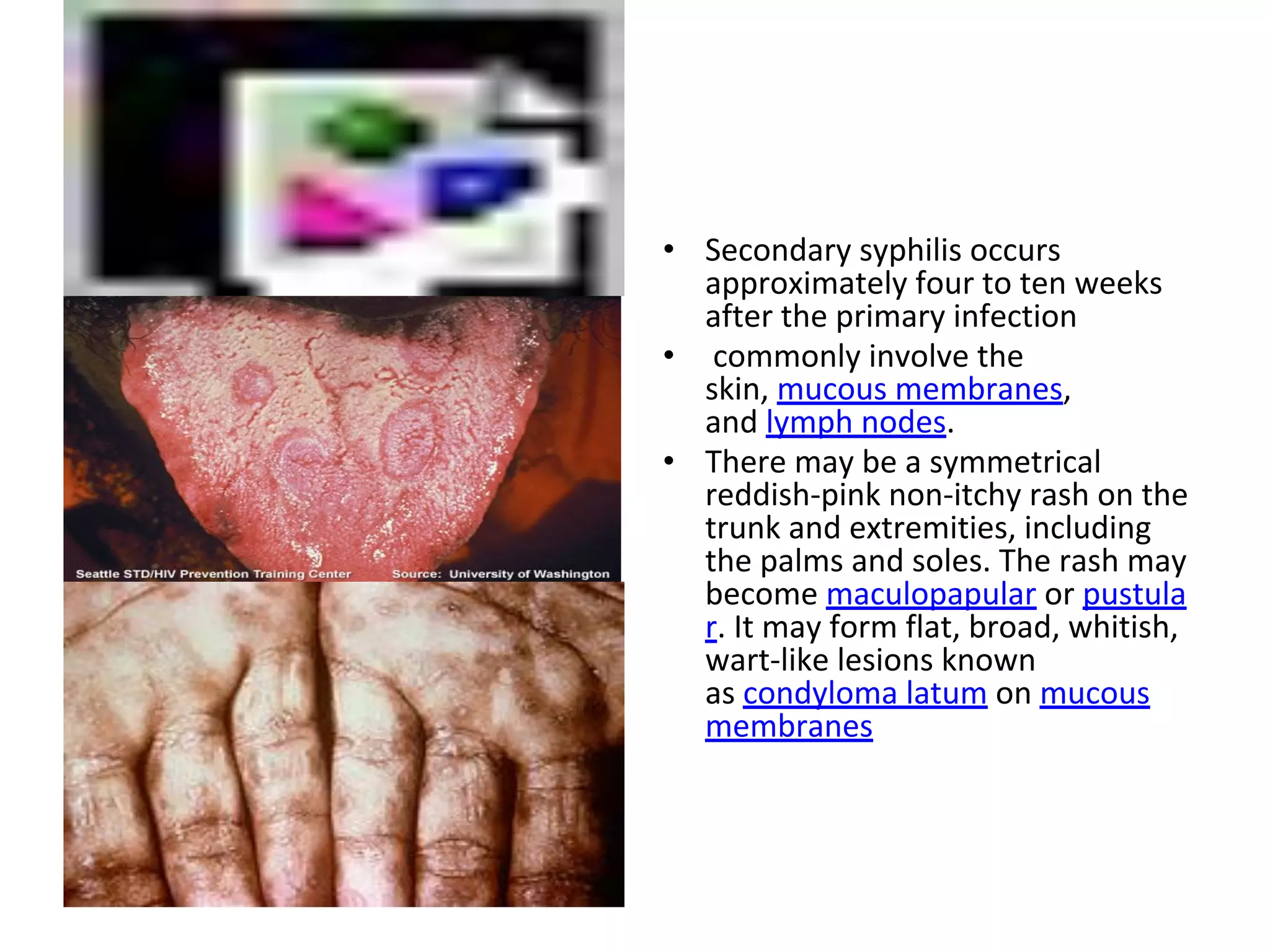 Skin systemic infections final | PDF